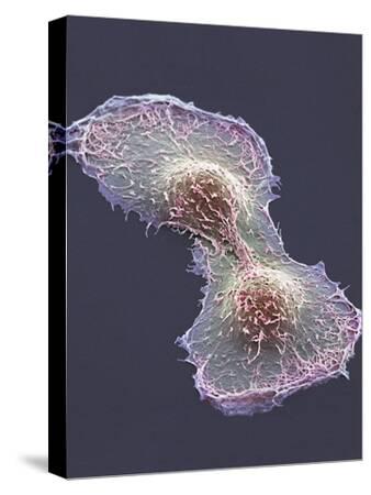 'HeLa Cell Division, SEM' Photographic Print - Thomas Deerinck | Art.com