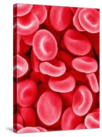 'Human Red Blood Cells' Photographic Print - Micro Discovery | Art.com