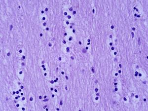 Beautiful Brain artwork for sale, Posters and Prints | Art.com