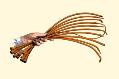 'Catheters' Art Print - Jules Porges | Art.com