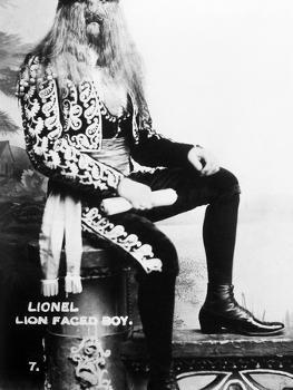'Lion-Faced Man, 1907' Photographic Print | Art.com