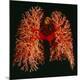 'Resin Cast of Pulmonary Arteries And Bronchi' Photographic Print ...