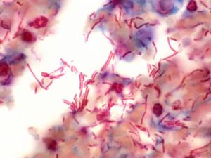 Beautiful Bacteria & Diseases artwork for sale, Posters and Prints ...