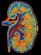 'Coloured CT Scan Through a Healthy Human Kidney' Photographic Print ...