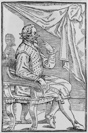 'Rhinoplasty Practiced in Venice by Gisparo Tagliacozzi. Woodcut, 1597 ...