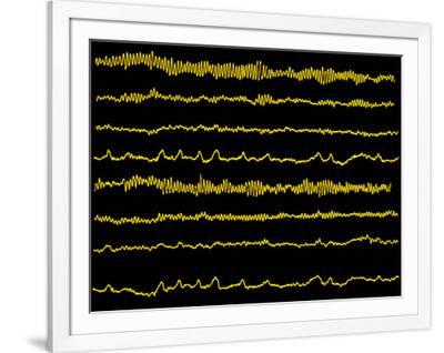 Eeg Normal