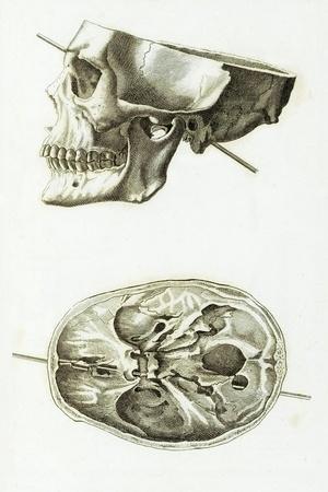 'Skull with Head Wound, Illustration, 1829' Giclee Print - Science ...