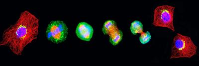 'HeLa Cell Division, SEM' Photographic Print - Thomas Deerinck | Art.com