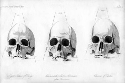 Types Of Human Skulls