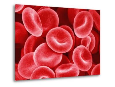 Human Red Blood Cells Photographic Print by Micro Discovery | Art.com