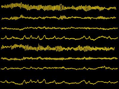 Normal EEG Read Out of the Brains Alpha Waves Photographic Print ...
